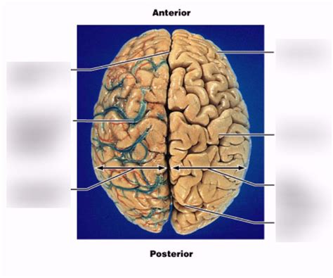 Cerebal Hemispheres Diagram Diagram Quizlet