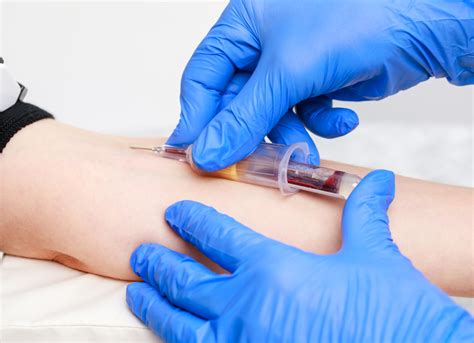 Análisis de sangre qué detecta resultados y enfermedades