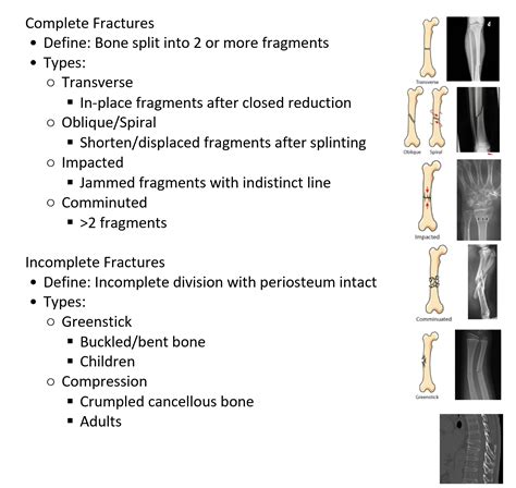 Complete Vs Incomplete Fracture