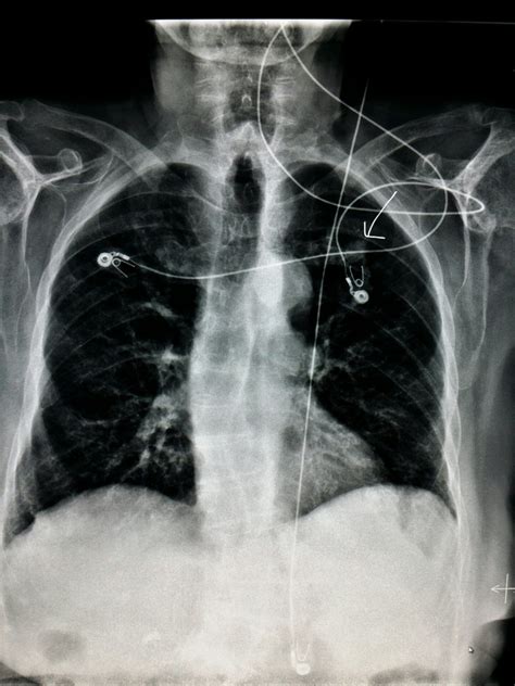 Xray Pictures