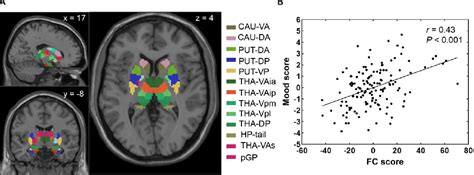 Figure 1 From A Distinctive Subcortical Functional Connectivity Pattern