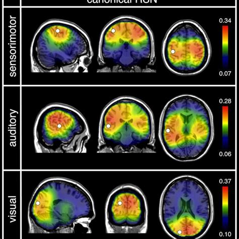 Whole Brain Spatial Similarity R Of Individual Single Session