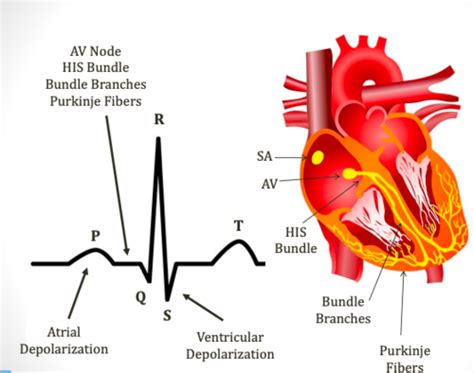 Av And Bundle Branch Blocks Flashcards Quizlet