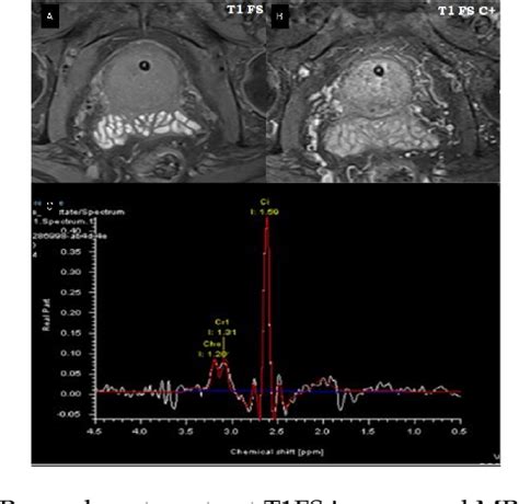 Figure 2 From Role Of Multiparametric Magnetic Resonance Imaging In The