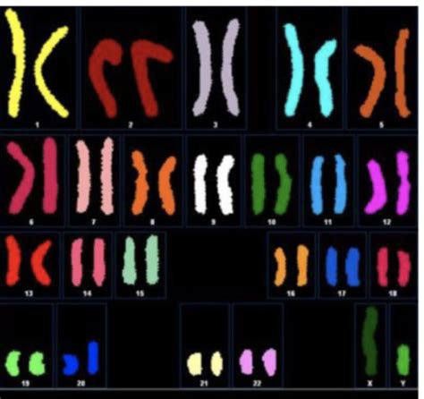 Chromosomal Abnormalities Flashcards Quizlet