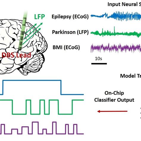 on chip classification of neural signals for epileptic seizure download scientific diagram