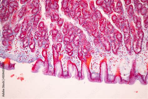 Tissue Of Small Intestine Duodenum Large Intestine Human And Stomach