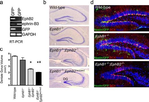 Combined Loss Of EphB1 And EphB2 Results In Even More Dramatic