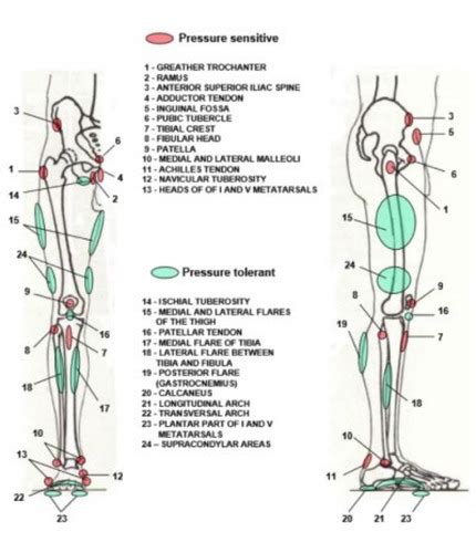 Orthotics Prosthetics Amputees Flashcards Quizlet