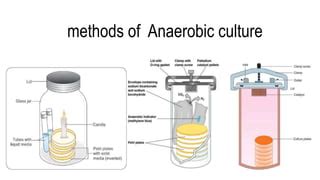10 ANAEROBIC CULTURE Pptx