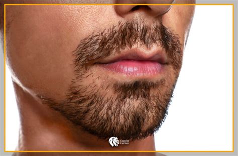 Famosos Hombres Con Barba De Candado Capilar Center