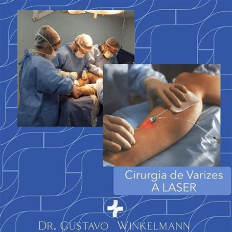 Cirurgia De Varizes A Laser Dr Gustavo Winkelmann