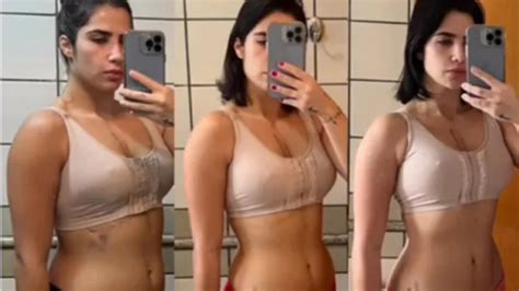 Foto Jéssica Costa mostrou antes e depois das próteses de silicone nos