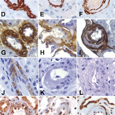 Histology And Immunostains Of Markers Of Arteriolar Vascular Smooth
