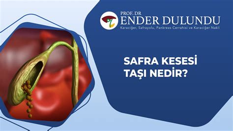 Safra Kesesi Taşı Nedir I Prof Dr Ender Dulundu YouTube