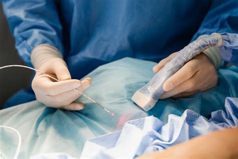 Flebologia Laserowe usuwanie żylaków Flebetica