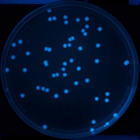 introduction bacteria colony counting based on machine learning algorithms