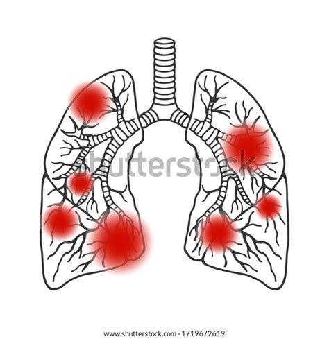 Human Lungs Detail Anatomy Eps10 Vector Stock Vector Royalty Free