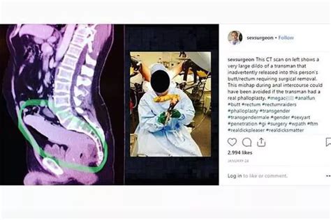 Gender Reassignment Surgeon Posted Photos Of Severed Genitals On
