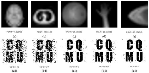 mathematics free full text robust zero watermarking algorithm for medical images using