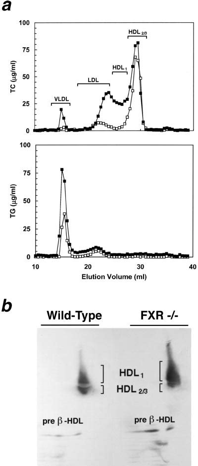 FXR Mice Have Increased Plasma HDL LDL And TG Rich Lipoproteins