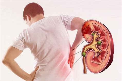 Các dấu hiệu cảnh báo suy giảm chức năng thận cần lưu ý