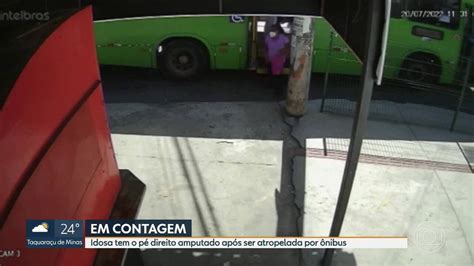 Vídeo Idosa tem o pé direito amputado após ser atropelada por ônibus