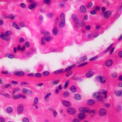 Stratified Squamous Epithelium Slide