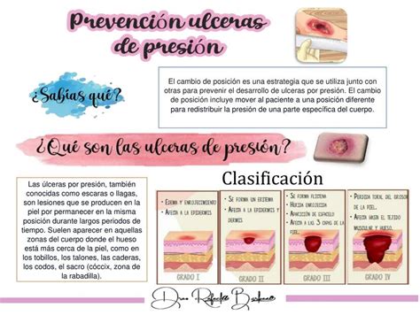 Úlceras por Presión Rafaela Burbano uDocz