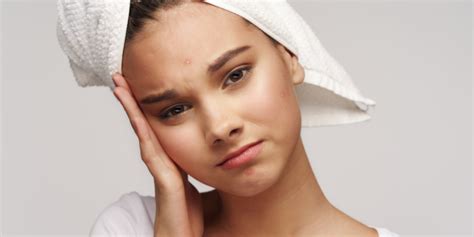 Urticaria en la cara por estrés PorEstrés