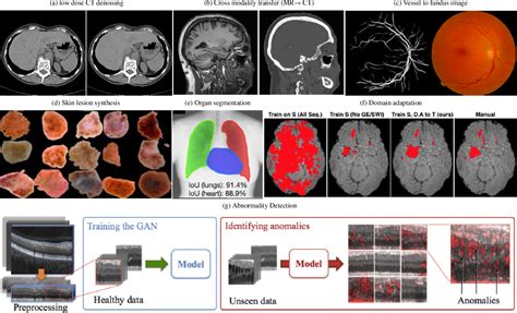 [pdf] generative adversarial network in medical imaging a review semantic scholar