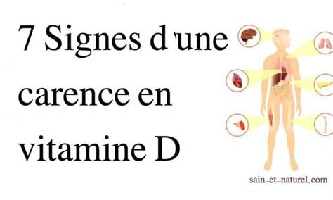 7 Signes Potentiels D Une Carence En Vitamine D