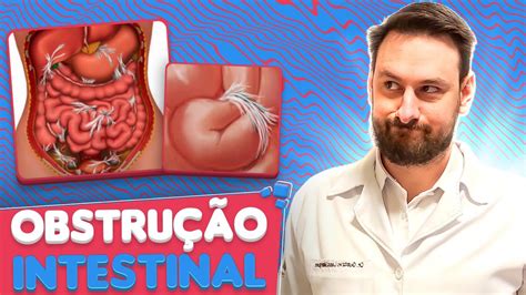 Médico explica o que é a OBSTRUÇÃO INTESTINAL SINTOMAS E TRATAMENTO