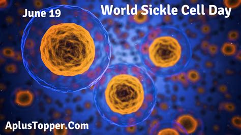 World Sickle Cell Day June 19th History And Importance Of World