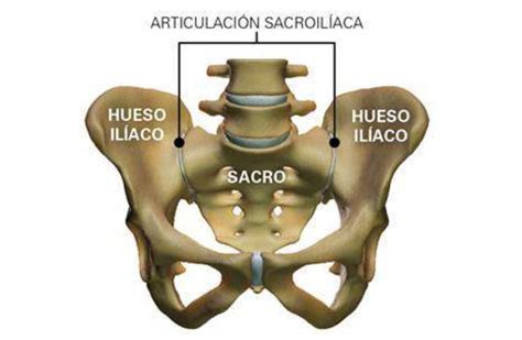Sacroileitis Dr Revenga Giertych Traumatólogo en Cádiz