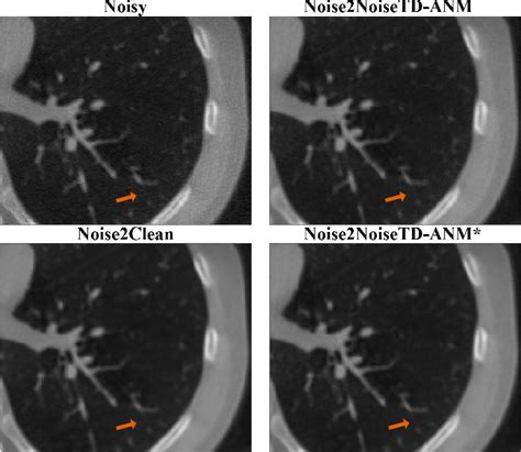 self supervised physics based denoising for computed tomography