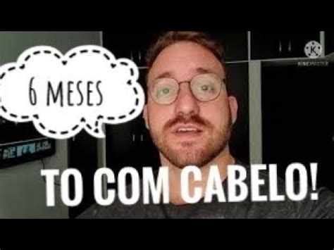 Meses De Transplante Capilar Fue Dias Youtube