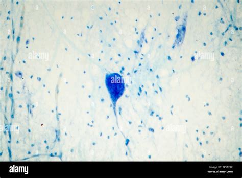 Light Micrograph Of Human Brain Tissue Showing Neurons And Glial Cells
