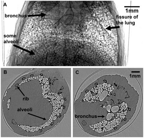 One Projection Image Is Shown In A The Bronchus And Some Alveoli Are